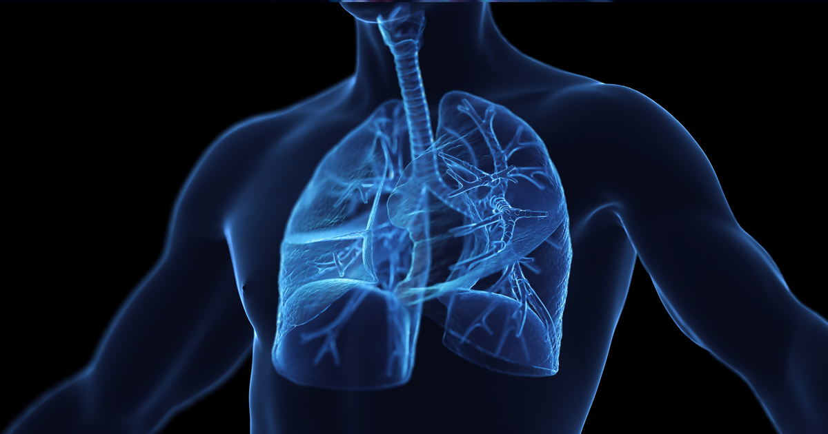 AHN Pulmonology: Advanced Lung Cancer Care Closer to Home