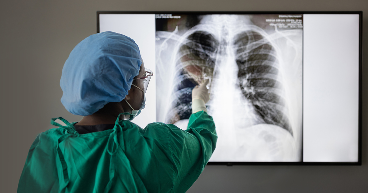 Kaposi Sarcoma Cancer Types, Symptoms and Diagnosis